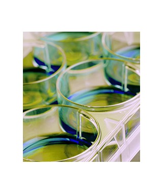 Blue-Green Algae and Microcystin Toxins – Nutrex Hawaii